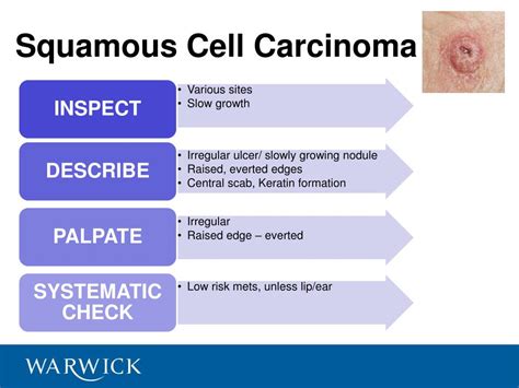 Squamous Cell Carcinoma Of Skin Pictures Squamous Cell Carcinoma