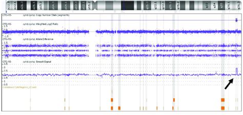 Image result for Duplication Chromosome Microarray