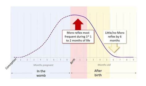 Image result for Moro Reflex Example