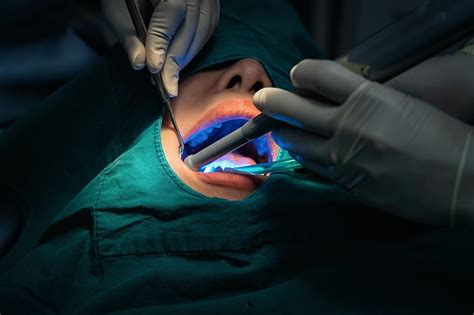 Image result for Surgical Tooth Extraction