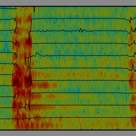 Image result for Audio Signal Processing