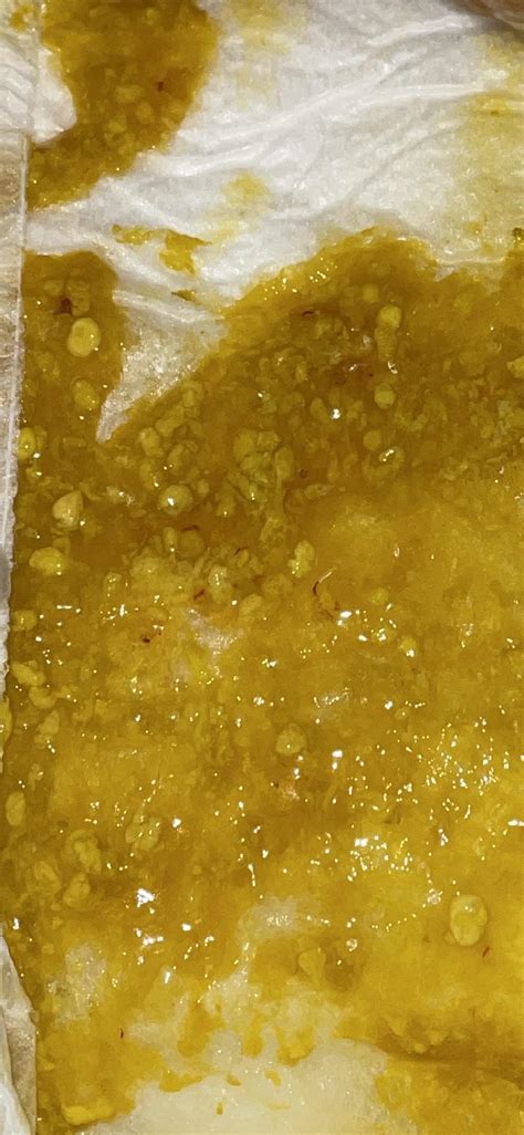 Image result for Yellow Stool Poop