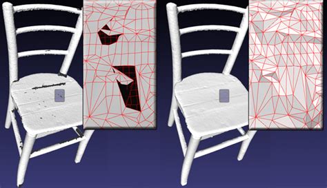 Image result for Open Mesh Repair