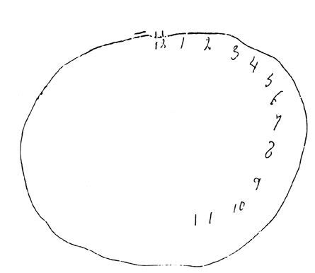 Image result for Contralateral Neglect