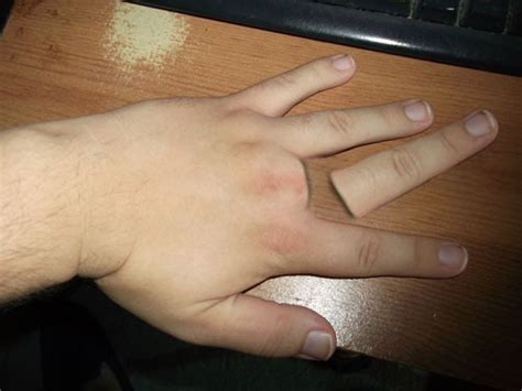 Image result for Cut Finger Tutorial
