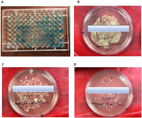 Image result for Microbial Profiling of the Samples
