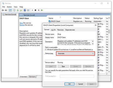Image result for DHCP Is Not Enabled for Local Area Connection