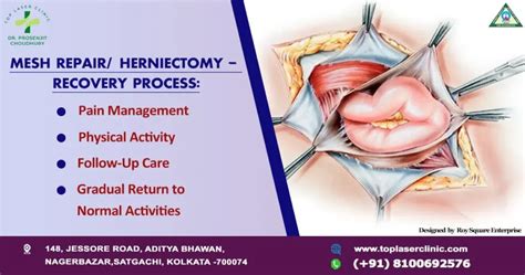 Image result for Open Mesh Repair