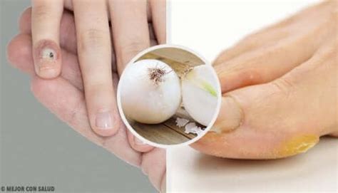 Image result for How to Remove Calluses Forever
