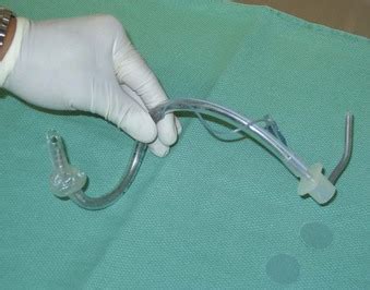 Image result for Digital Intubation