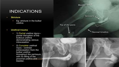 Image result for Retrograde Urethrogram Book