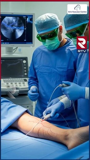Avis Vascular Centre | Non Surgical Treatment | Best Varicose Veins Treatmen𝐭 | Avis Hospitals | RTV