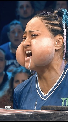 ONLY PEOPLE WITH STRONG JAW WIN IN THIS SPORT #slapbattles #slap #ufc