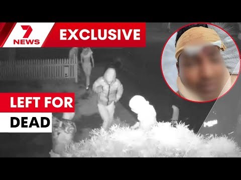 Melbourne’s chauffeur to the stars bashed and left for dead in sickening random attack | 7NEWS
