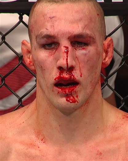 Blood Bath 🩸 🛁 Is Robbie Lawler vs Rory MacDonald 2 the best fight in UFC HISTORY?! | UFC