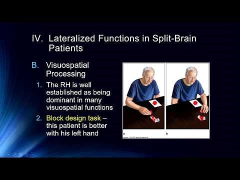 Lecture #19 Hemispheric Specialization: Split-Brain Procedures