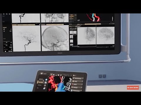 Get to know today’s Philips Azurion Image Guided Therapy