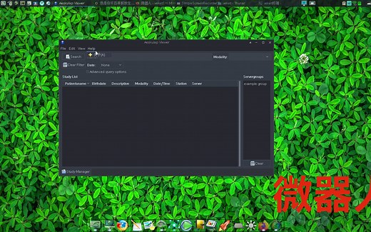 dicom文件怎么打开,dicom医学影像软件,医学图像查看工具及DICOM网络客户端aeskulap