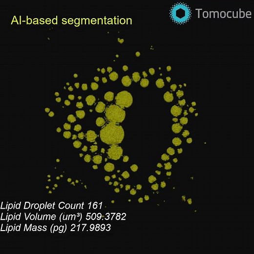 Quantification of Lipid Droplet Maturation in Differentiated Adipocyte Cells