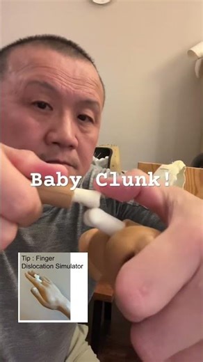 FINGER DISLOCATION : 2 Reduction Technique choices? #orthopedic #fingerdislocation