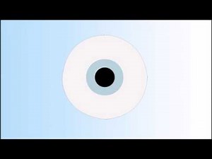 Hyperopia Explained Annimated Video