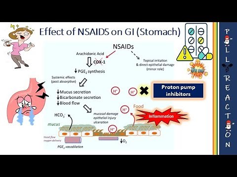 NSAIDs and Peptic Ulcer | Side effects | Gastric Bleeding | Kidney Injury