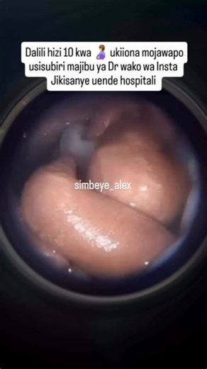 Alex simbeye | ⚠️ Dalili 10 za Hatari kwa Mama Mjamzito (hasa mimba ya kwanza) “Kama wewe ni mjamzito, dalili moja tu kati ya hizi ikikutokea, unapaswa... | Instagram
