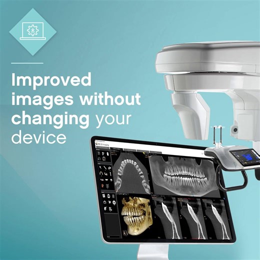 ⏱️💻 How can automatic software updates improve your clinical experience in just 5-10 minutes? 👉Read more: https://ow.ly/QAsv50W8aNM #CSAdvantage #CSImaging 8 #AutoUpdates #warrantyextension #digitaldentistry #carestreamdental | Carestream Dental