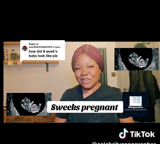 What to Expect at 8 Weeks Pregnant: Ultrasound, Symptoms & More