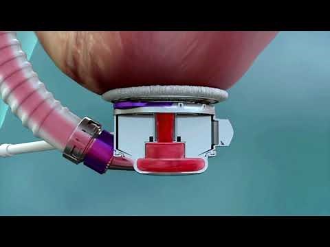 HeartMate 3 Animation