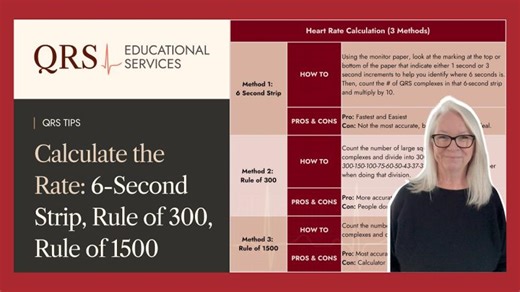 QRS Tips: Three Methods to Calculate Heart Rate on an ECG | QRS Educational Services | QRS Educational Services