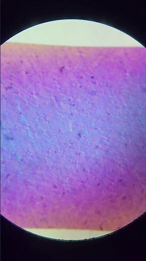 SPERM Histology at 25x, 40x,100x, 200x and 400x magnification | SPERM under the miscroscope