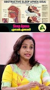 എന്താണ് ഒബ്സ്ട്രക്റ്റീവ് സ്ലീപ് അപ്നിയ? പുതിയ തലമുറയിലെ ഉറക്കമില്ലായ്മ | Obstructive Sleep Apnea