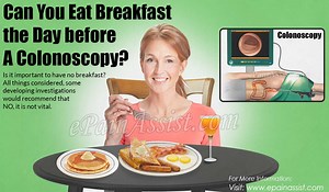Can I have toast 2 days before a colonoscopy? [2025] | QAQooking.wiki
