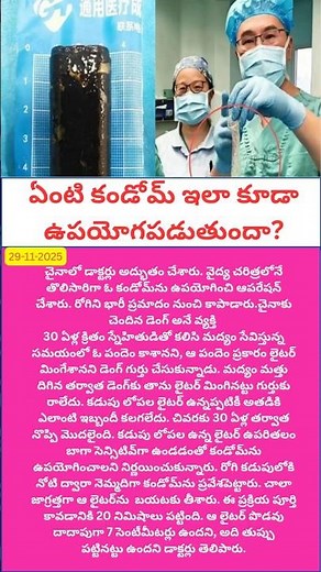 ఏంటి కండోమ్ ఇలా కూడా ఉపయోగపడుతుందా? 🤔 | “Doctors Use Condom Method to Remove 30-Year-Old Lighter ” 😇