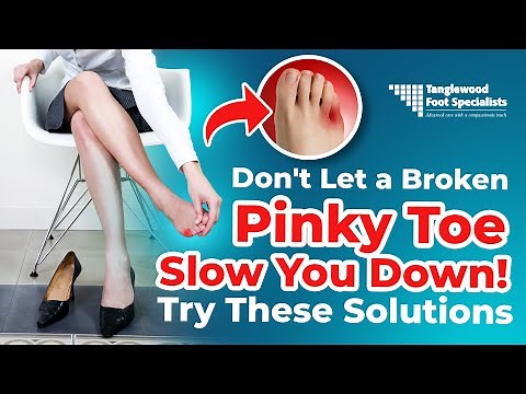 Don't Let a Broken Pinky Toe Slow You Down! Try These Solutions