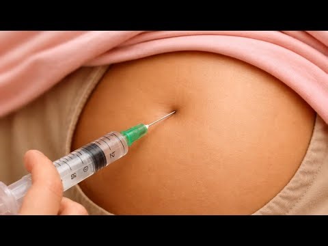 How to Give IM Injection in Buttock (Gluteal Region)