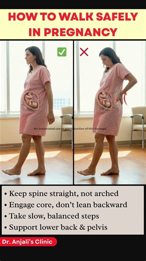 STOP Walking Like This During Pregnancy 🚨 Correct Walking Posture in Pregnancy