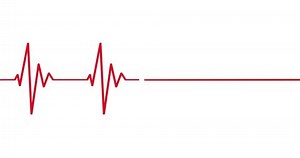 Heartbeat Line Heart Pulse Ecg Beat Stock Footage Video (100% Royalty-free) 1075876829 | Shutterstock