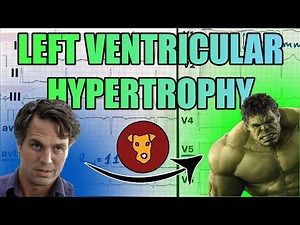Left Ventricular Hypertrophy Made Easy: ECG + Echo Explained in 5 Minutes!