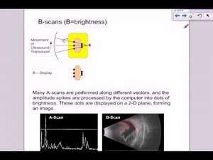 A level medical physics - ultrasound part 2 types of scan, A-scans, B-scans and M-scans