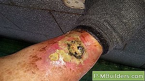 Septische Tankablass-Feldreparatur-Anleitung: Verstopfungs-Versagen 🔧🔧 Tipps Für Heimwerker. Machen Sie Ihre Eigenen Hände - 2025