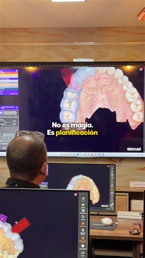 Cuando la planificación es correcta, la cirugía solo obedece🦷⚡️ #dentalsurgery #dentistryworld #planificacion #exocad #3shape