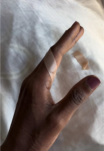 Face Taping: Ultimate Guide for Wrinkle-Free Skin