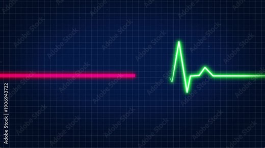 Heart Failure, Life Stopping, Medical Emergency, Health Crisis, Cardiac Arrest, And Critical Care Concepts. Medical Animation of a Green Heartbeat Wave Transitioning Into A Straight Red Flatline.