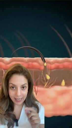 Side effects of ingrown hair and how to treat it. Not everything that appears on your skin keratosis pilaris is sometimes the follicle itself is infected, which can give the appearance of dark patches dark spots, and it can also get infected. #bodycare #skincareroutine #skincaretips #skincareproducts | nipunkapur