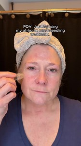 Miski Cosmetics on Instagram: "Glow mode: ON ✨ Just me, my skin, and a little self-care magic at home. #microinfusion #microneedling #antiaging #skincare #serum"