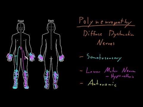 Syndrome: Polyneuropathy