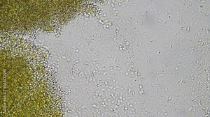 baby feces under the microscope looking at poo with bacteria and bugs in a laboratory