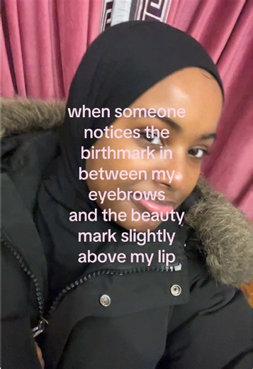 Understanding My Subtle Birthmark Journey